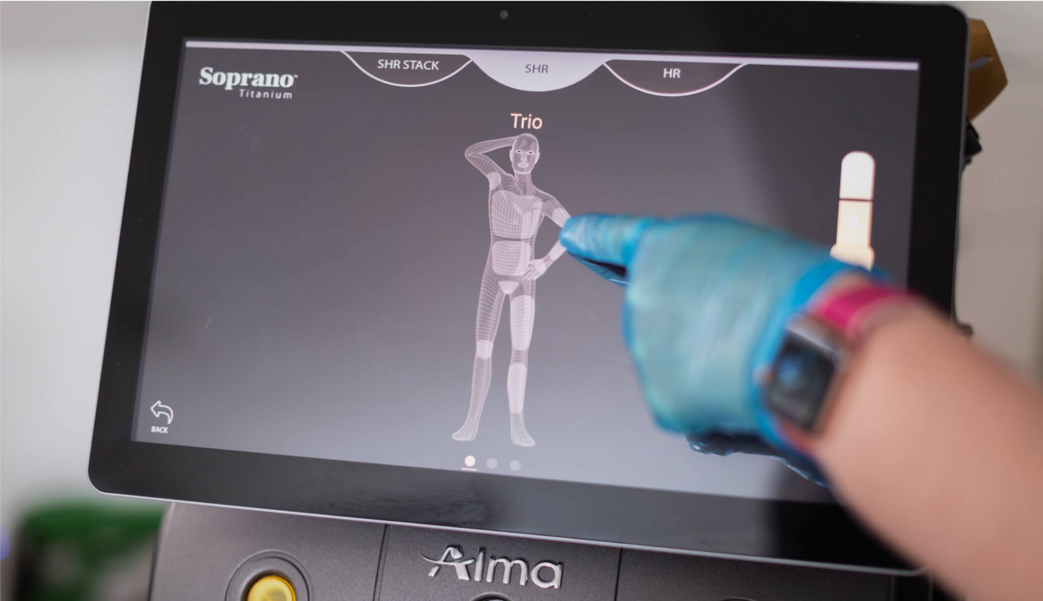 Soprano Ice Titanium Laser Hair Removal - Cindy Knight Clinic